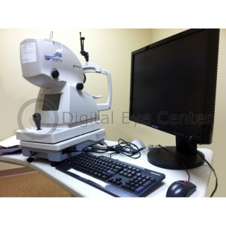 OCTs – Digital Eye Center