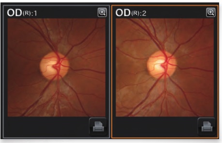 Topcon TRC NW400 NM Fundus Camera - Refurbished - Digital Eye Center