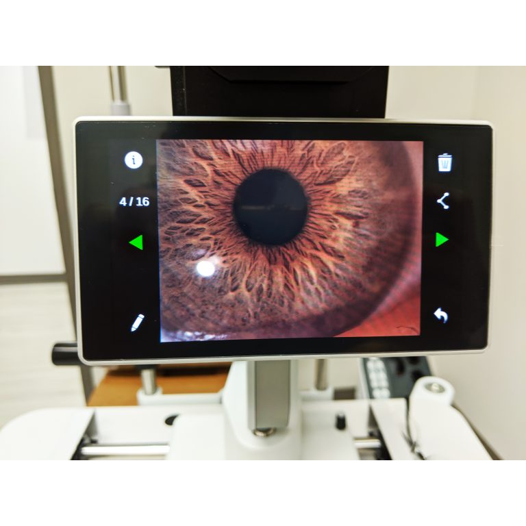 Frey Slit Lamp Digital Imaging System - Digital Eye Center