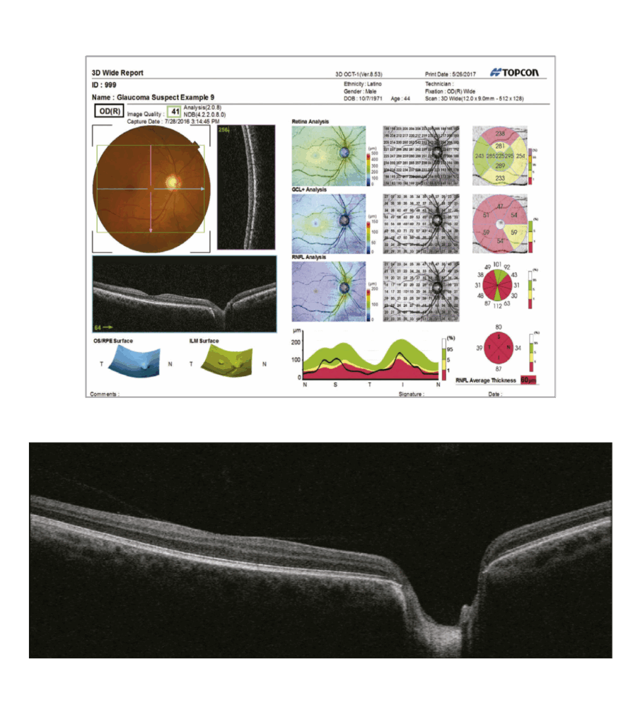 Topcon Maestro 1 OCT - Refurbished - Digital Eye Center